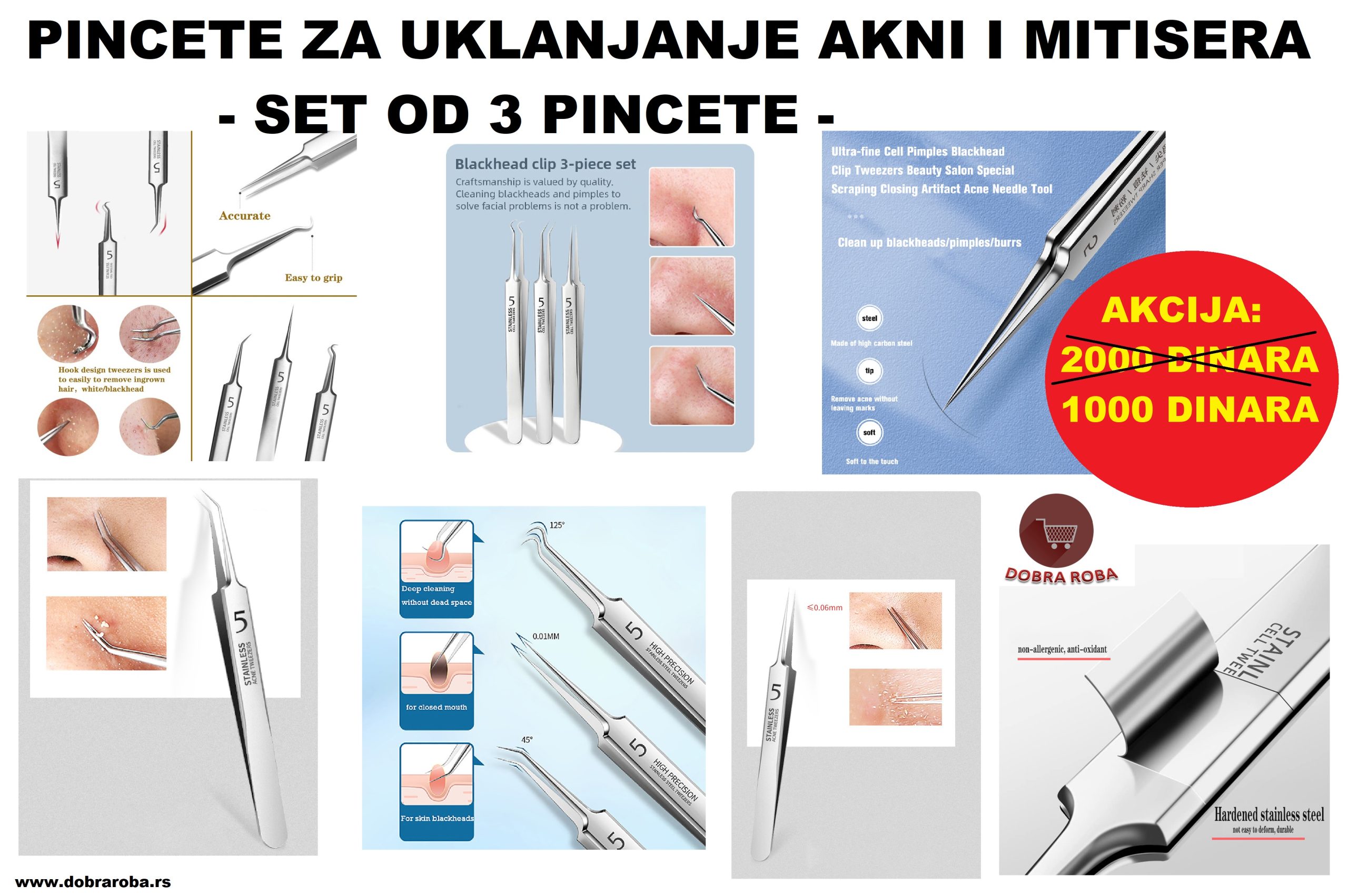 PINCETE ZA UKLANJANJE AKNI I MITISERA - SET 1/3 - Dobra roba